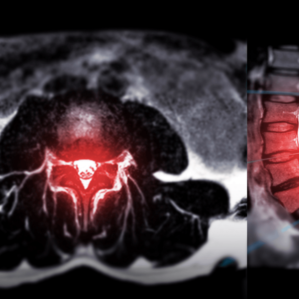 Spine Care Center in Abu Dhabi | Burjeel Day Surgery, Al Reem
