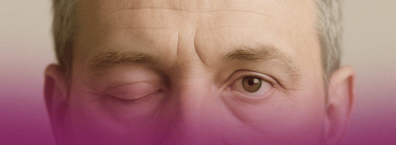Oculoplastic Surgery | Dr. Haitham - Eyelid Surgeon in Abu Dhabi