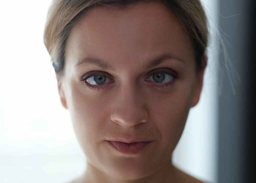 Squint Treatment | Burjeel Hospital Abu Dhabi | Expert Eye Care