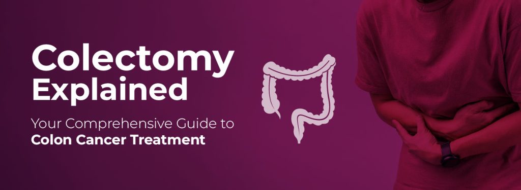 Guide to Colon Cancer Treatment | Colectomy Procedure