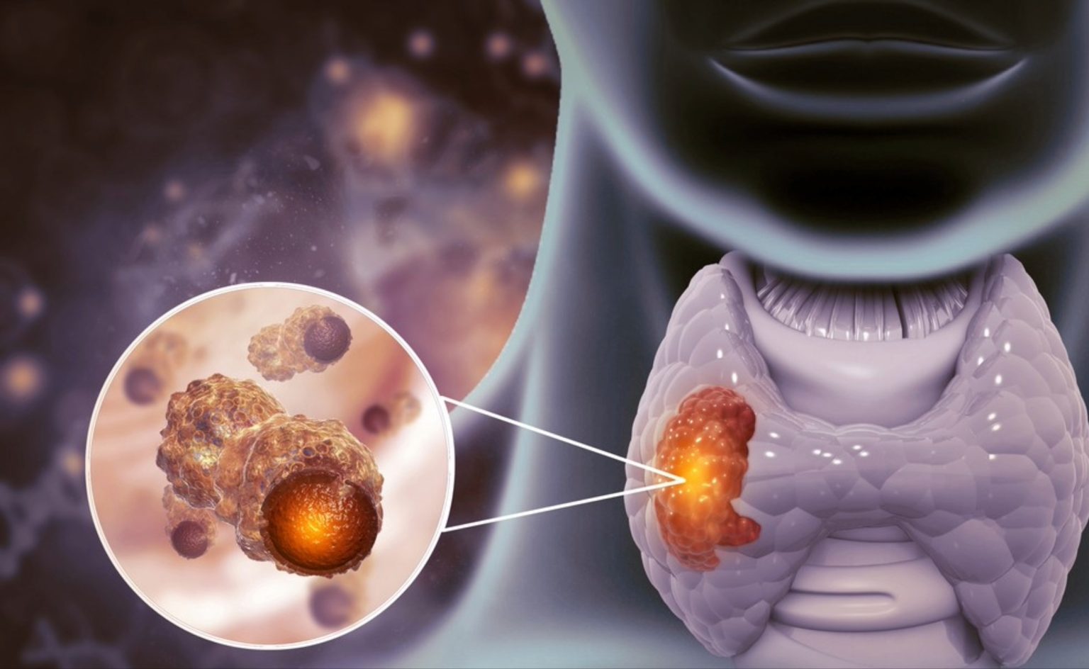 Recognize the 10 Early Signs of Thyroid Cancer | Burjeel Royal, Al Ain